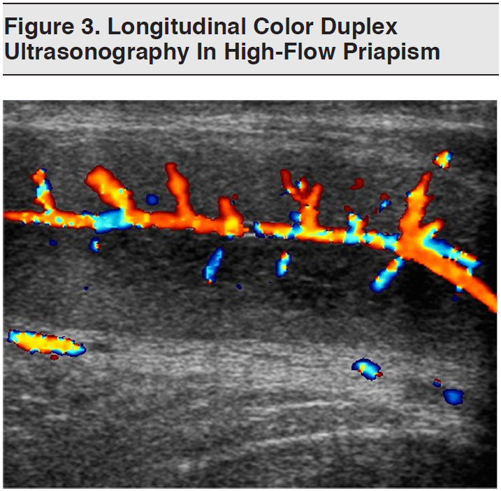Tables And Figures | Priapism