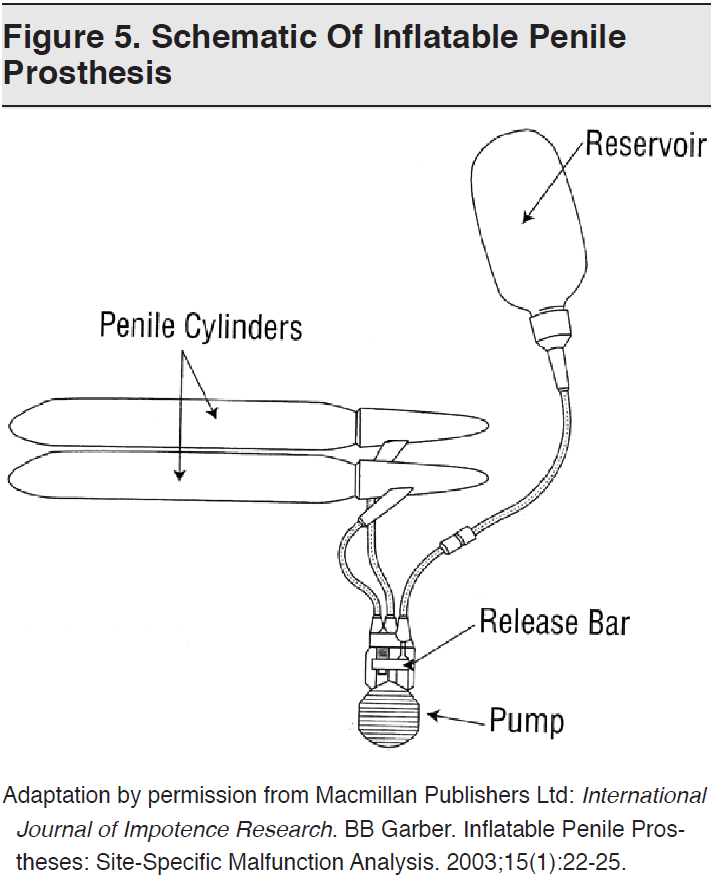 Tables And Figures | Priapism