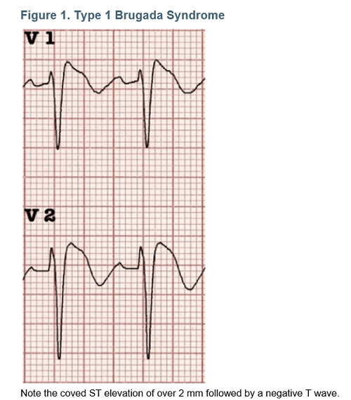 Urgent Care Approach to the Syncopal Patient