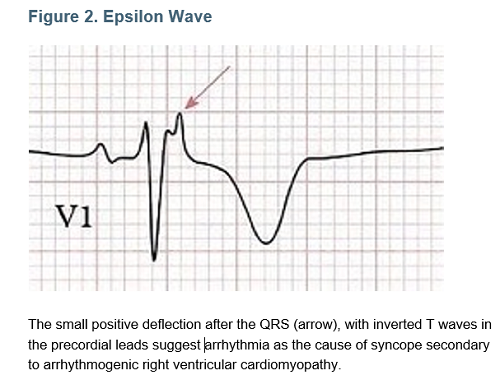 Urgent Care Approach to the Syncopal Patient