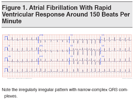 Atrial Flutter Findings