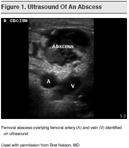 Emergency Department Infections In The Era Of Community-Acquired MRSA