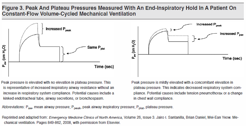 Difficulty Ventilating