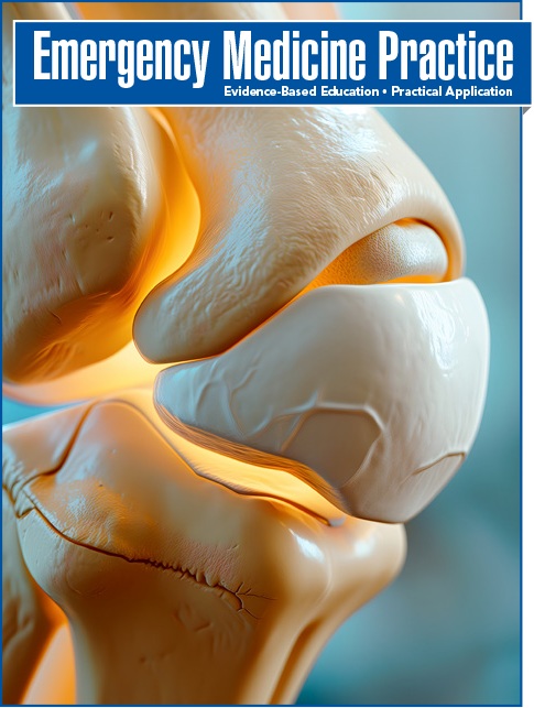Emergency Department Management of Knee Pain | Store
