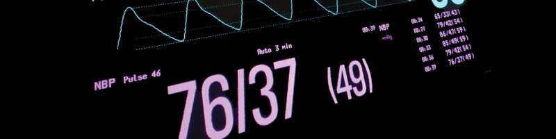 Emergency Department Management of Hypotensive Patients