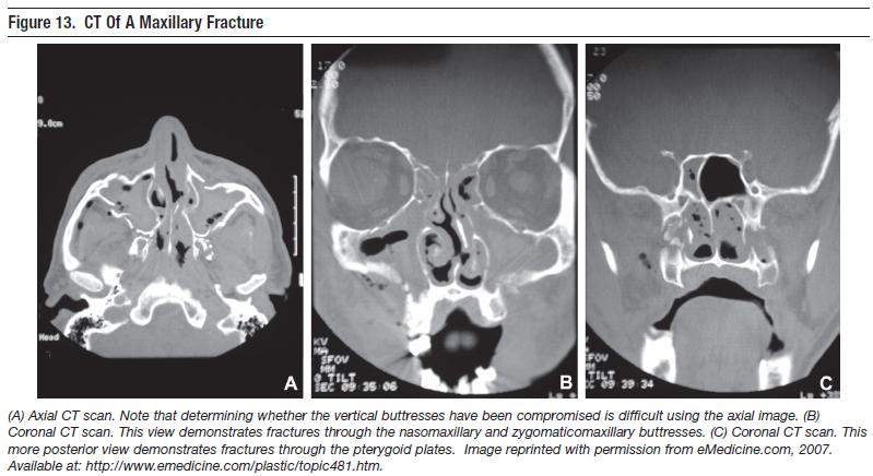Radiographic Views Of The Frontal Bone