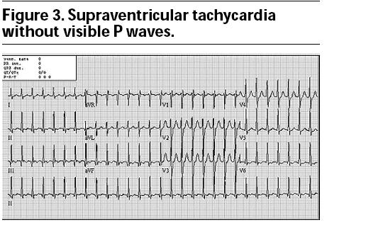 Differential Diagnosis